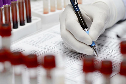 Biomarker blood test could reveal high risk heart patients in need of ...