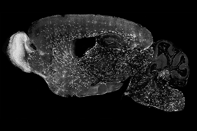 Genetic work provides insight into nerve cell process called ...