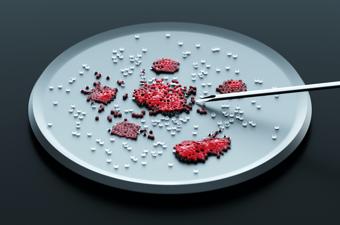 UTSW scientists identify cancer-suppressing genetic mutation: Newsroom ...